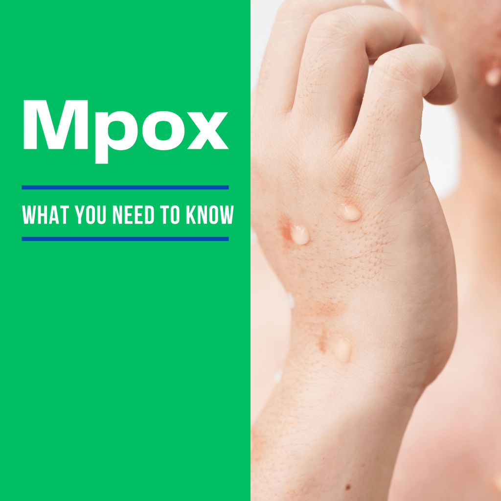 New Clade Ib Mpox case in England: What you need to know - Healthy.mt